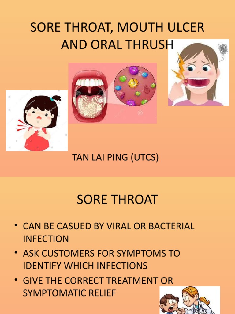 Sore Throat, Ulcer, Oral Thrush | PDF
