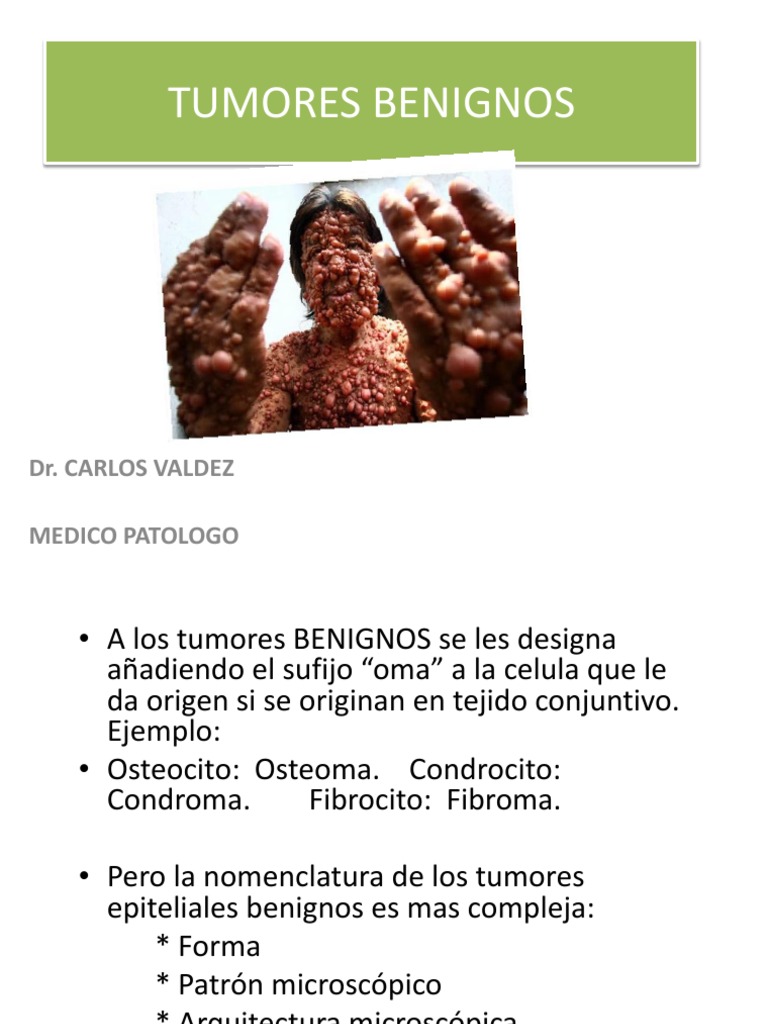 Tumores Benignos | PDF