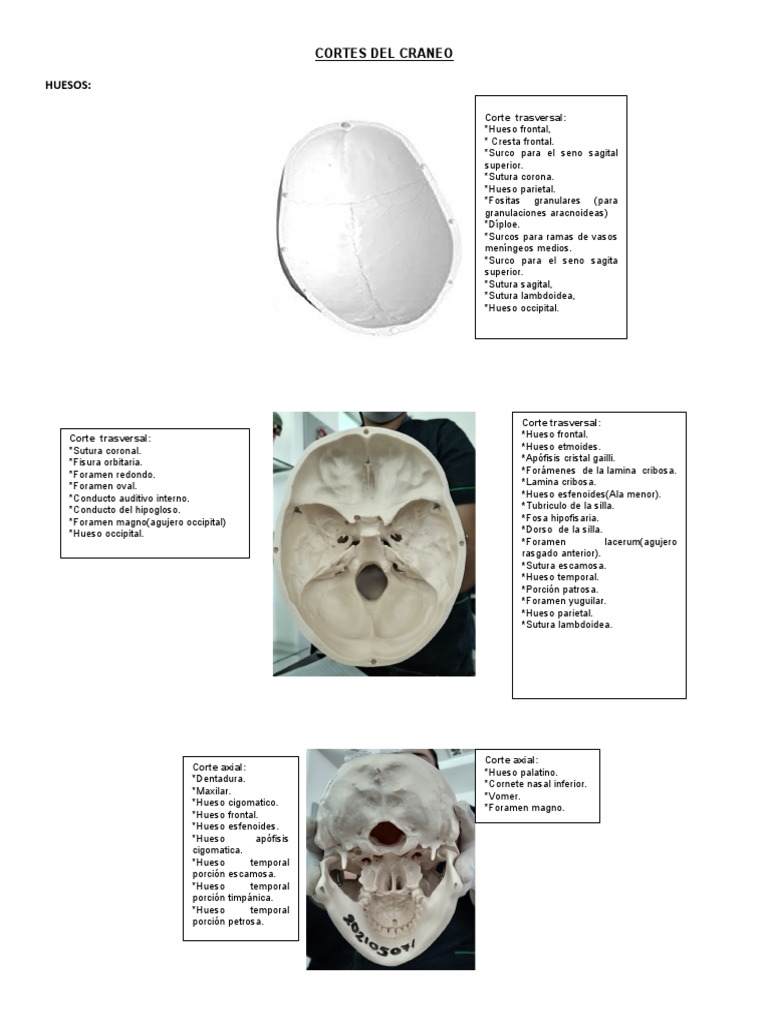 Tipos de cortes del cráneo y cerebro | PDF | Anatomía | Cabeza y cuello ...