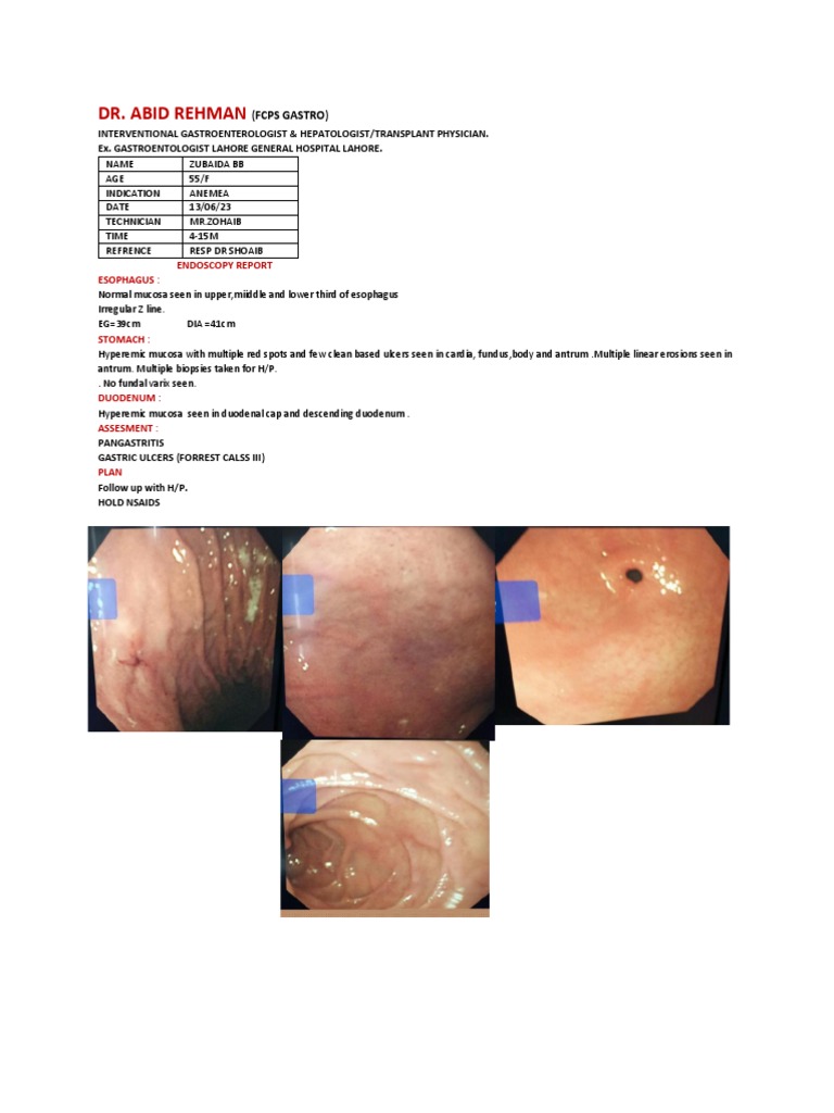 Upper Endoscopy Red | PDF