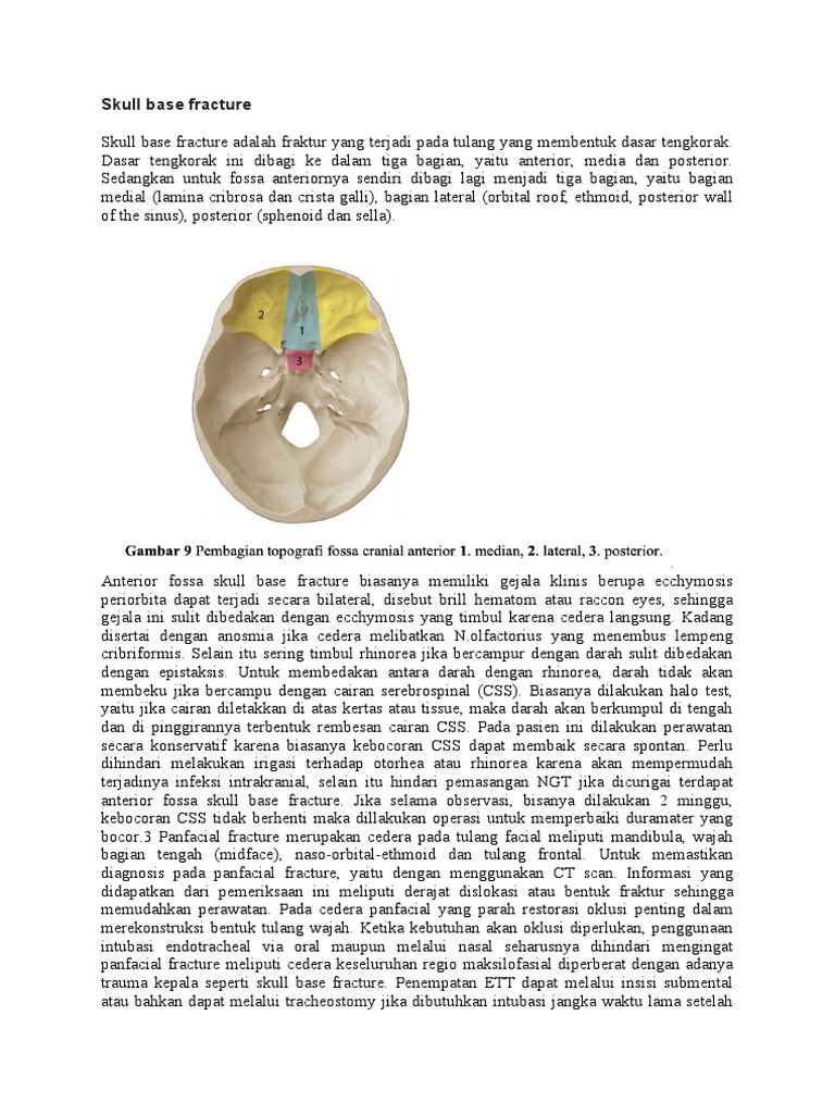 Skull Base Fracture | PDF