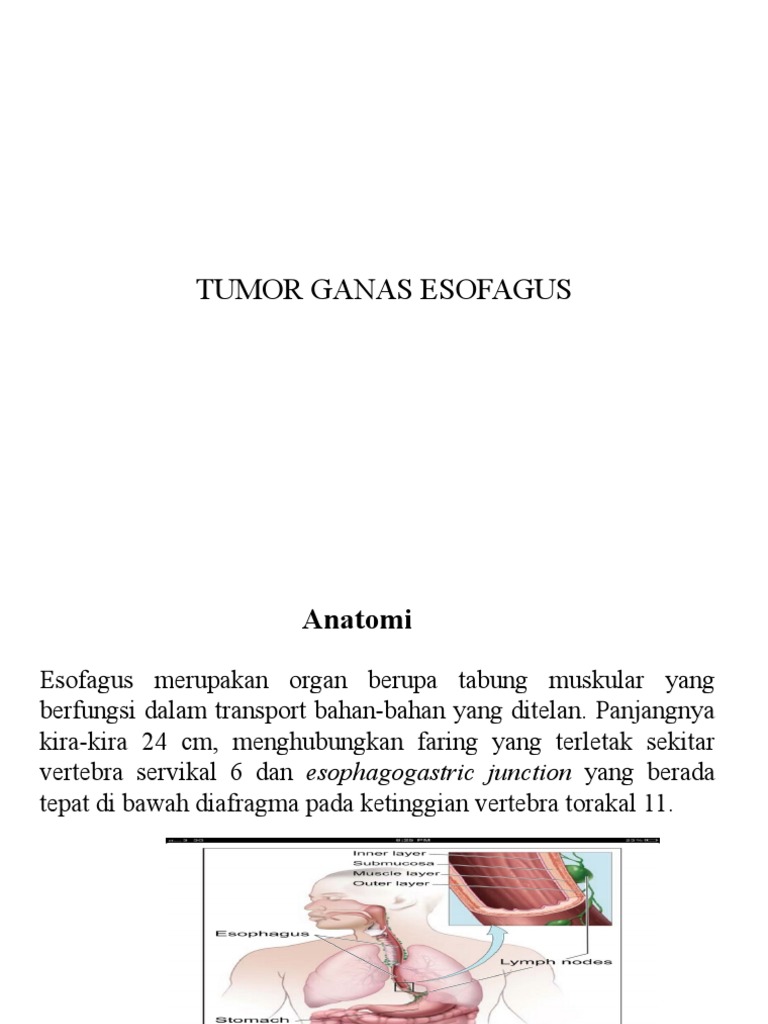 Tumor Esofagus | PDF | Pengembangan Diri | Sains & Matematika