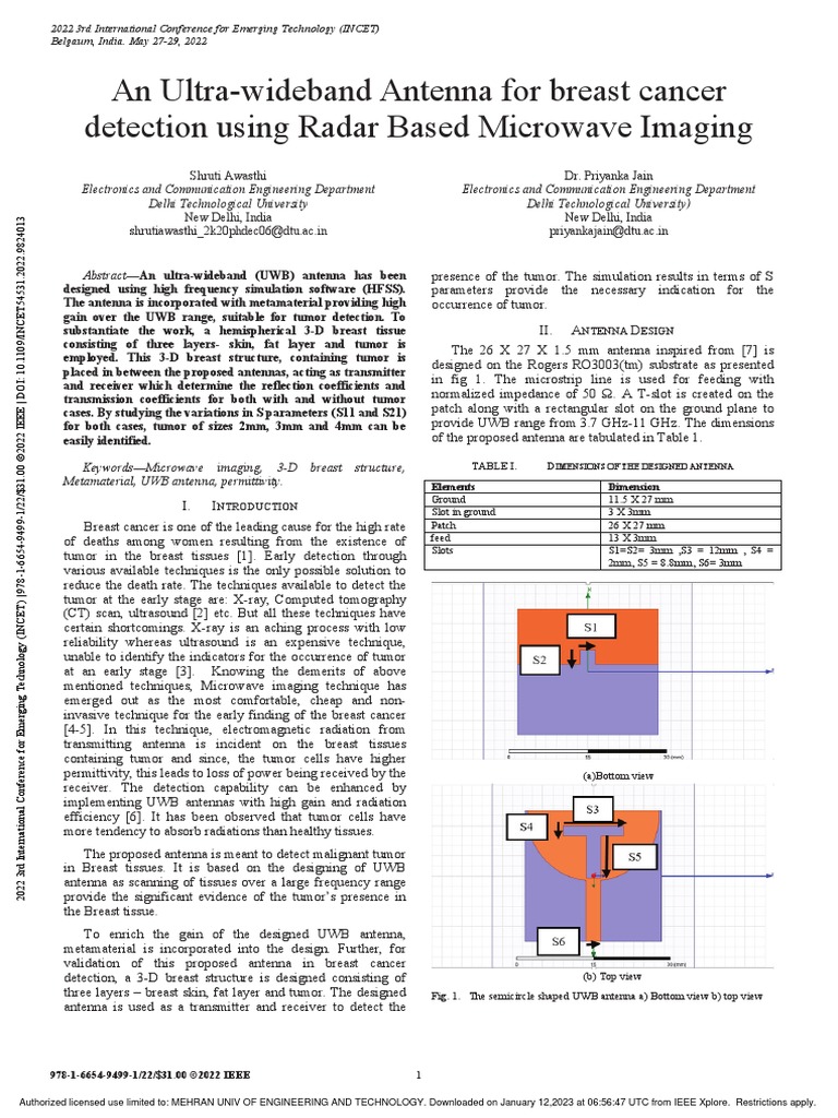 An Ultra-Wideband Antenna For Breast Cancer Detection Using Radar Based ... An Ultra-Wideband Antenna For Breast Cancer Detection Using Radar Based ...