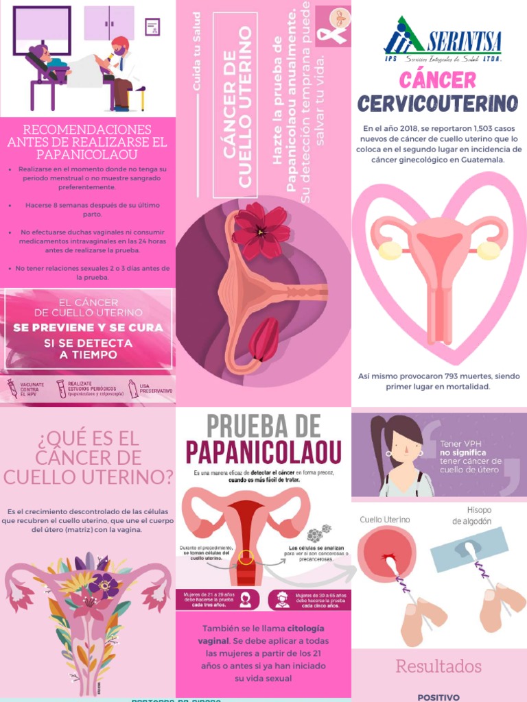 cancer-cervicouterino | PDF