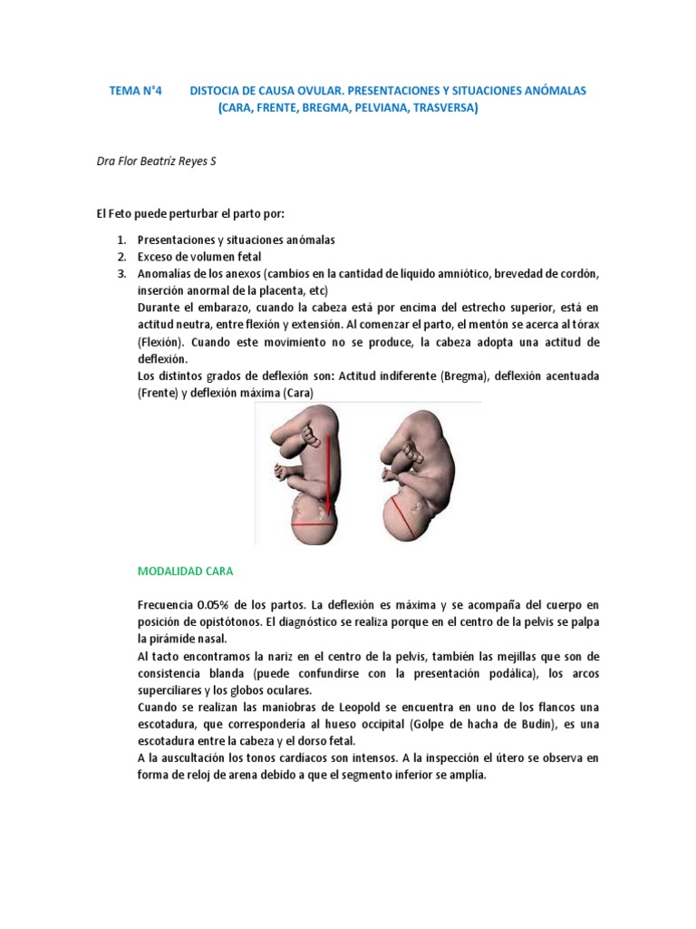 Tema 4. Distocias | PDF | Parto | Anatomía