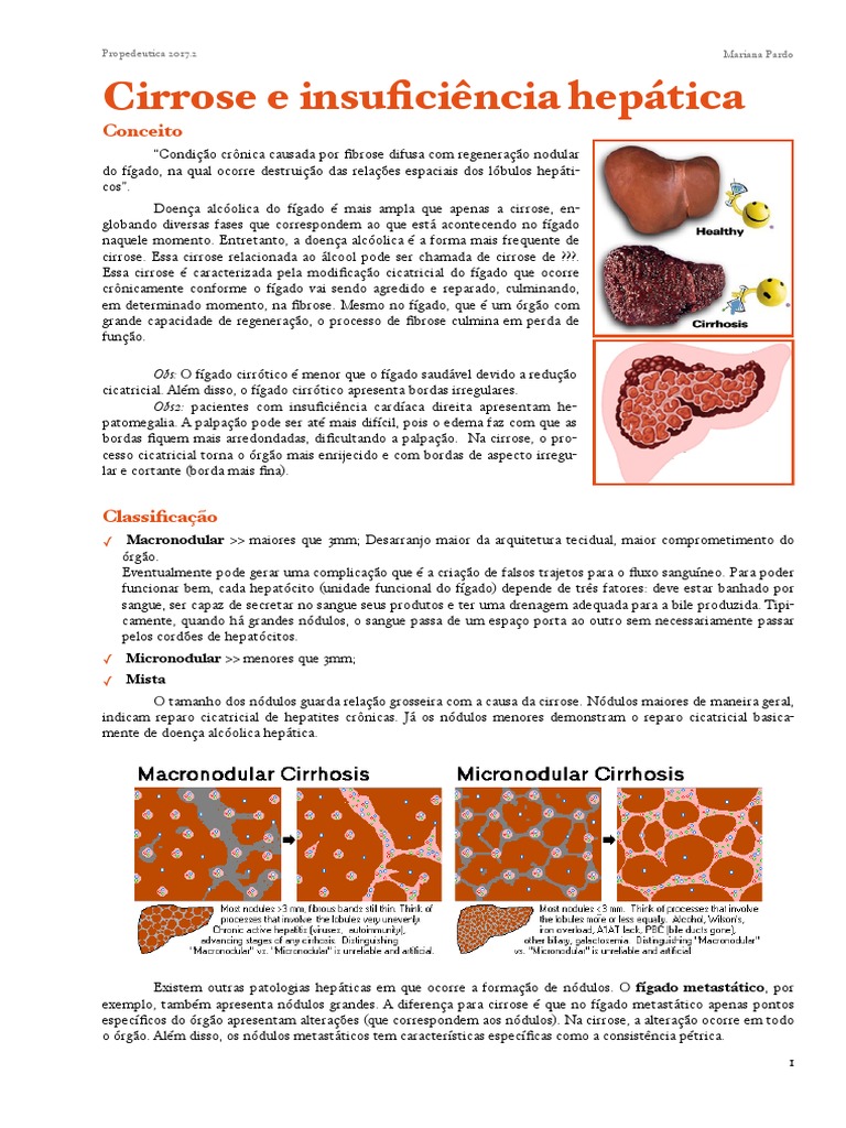 Cirrose Hepática: Causas e Sintomas | PDF