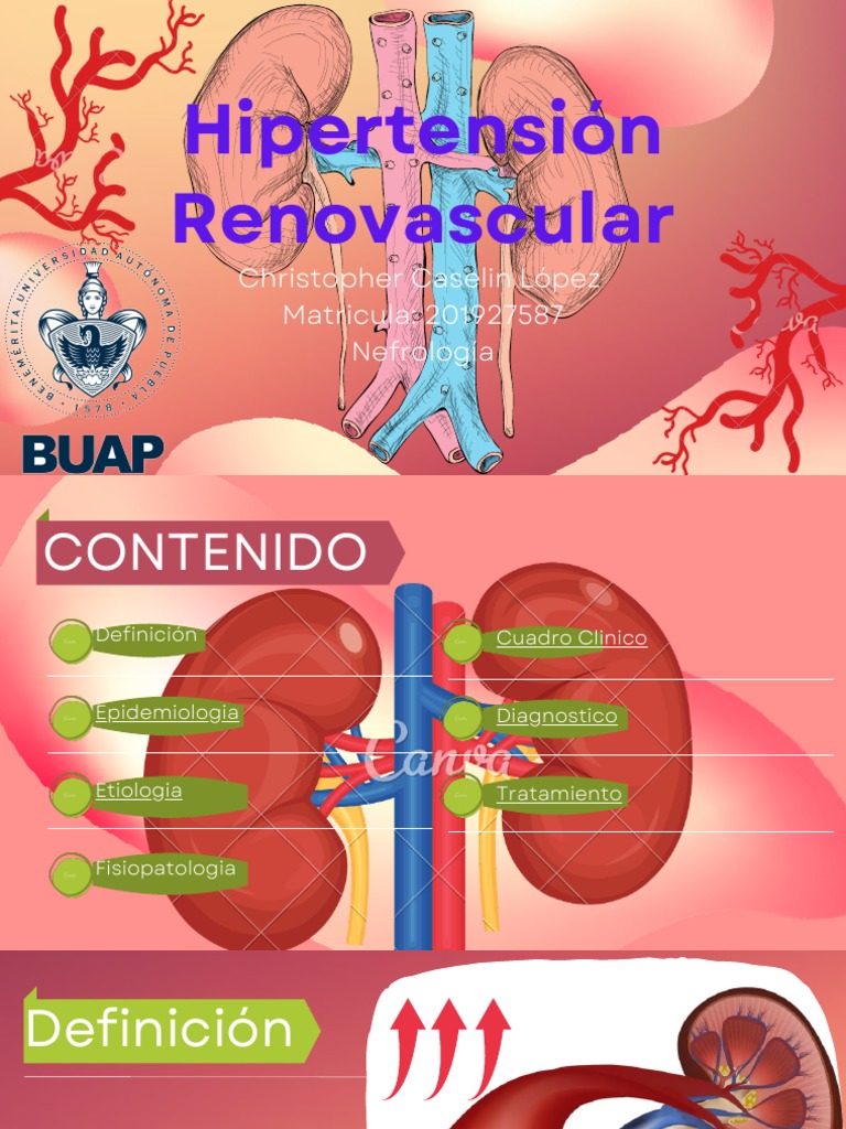 Hipertension Renovascular | PDF | Hipertensión | Riñón