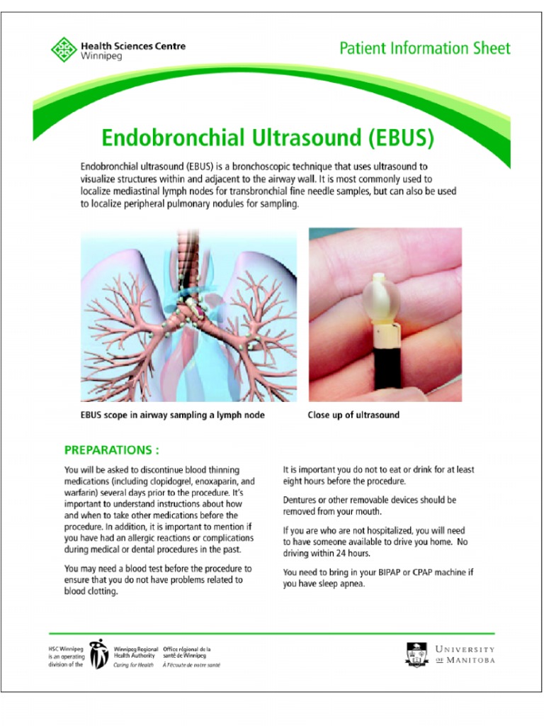 01-Jun-2023 EBUS Patient Info Invest. PKG Patient Information Sheet Pg.1 6 | PDF