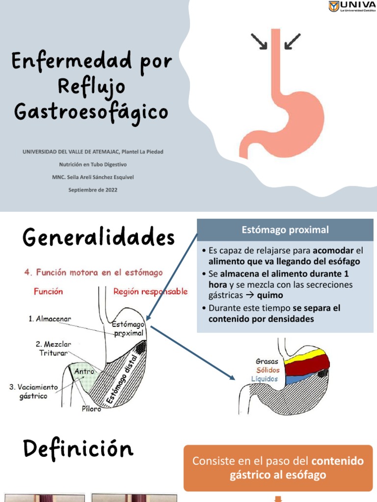 Erge | PDF | La enfermedad por reflujo gastroesofágico | Acidez