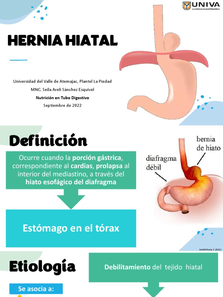 Hernia Hiatal | PDF | Medicina CLINICA | Especialidades Medicas