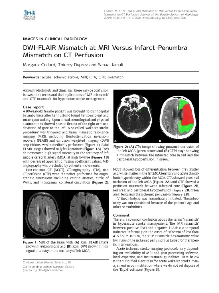 DWI-FLAIR Mismatch at MRI Versus Infarct-Penumbra Mismatch On CT ...