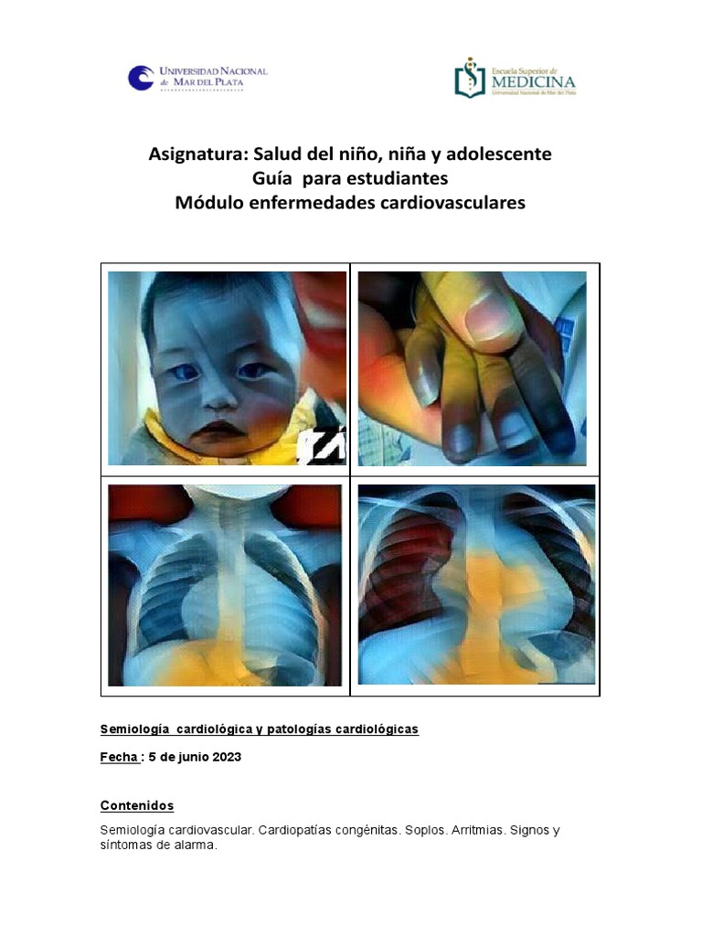 Semiología Cardiovascular en Niños y Adolescentes | PDF | Defecto ...