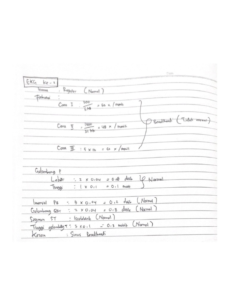 Tugas EKG - Syamsinar - R014212019 | PDF