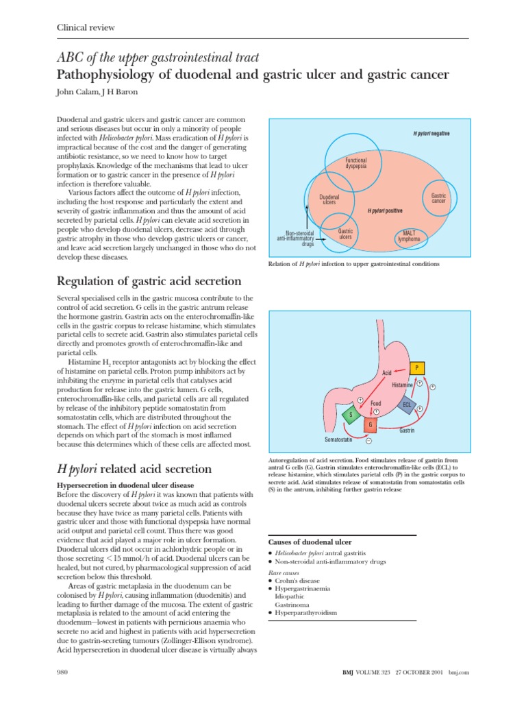 Upper GI Tract: Ulcers & Cancer Insights | PDF | Stomach | Epidemiology