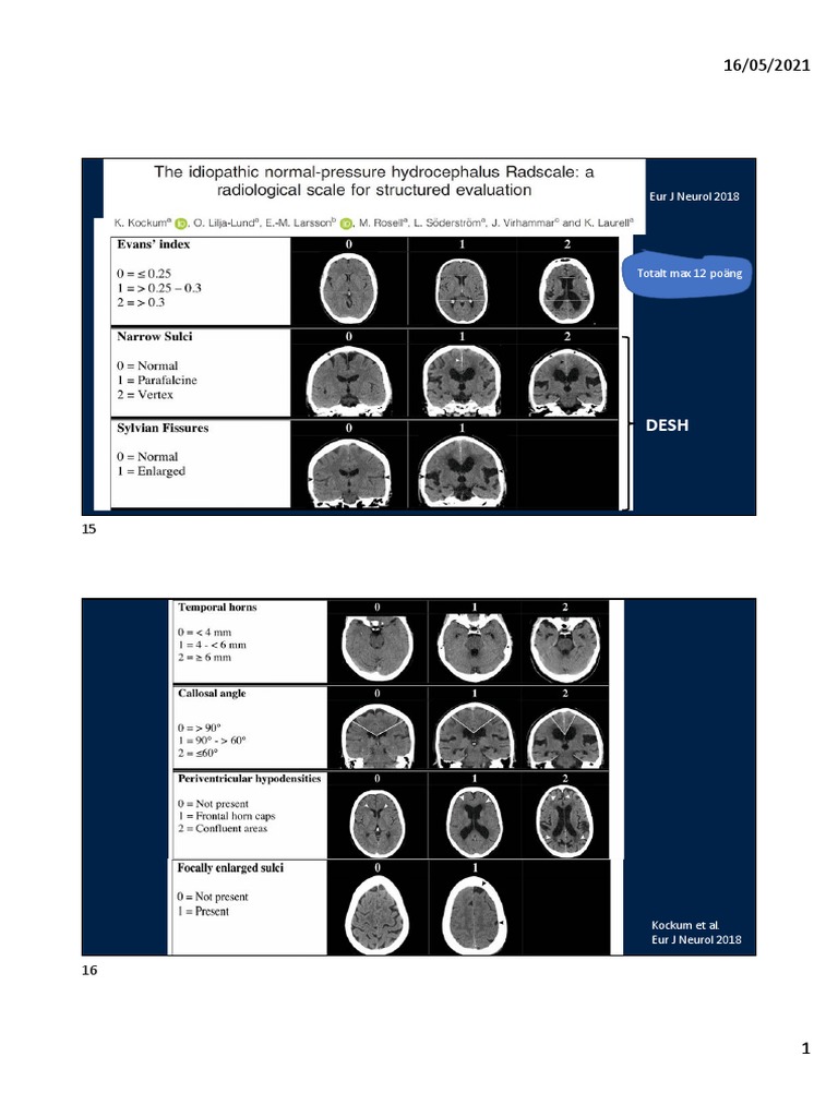 NPH Radscale CT | PDF