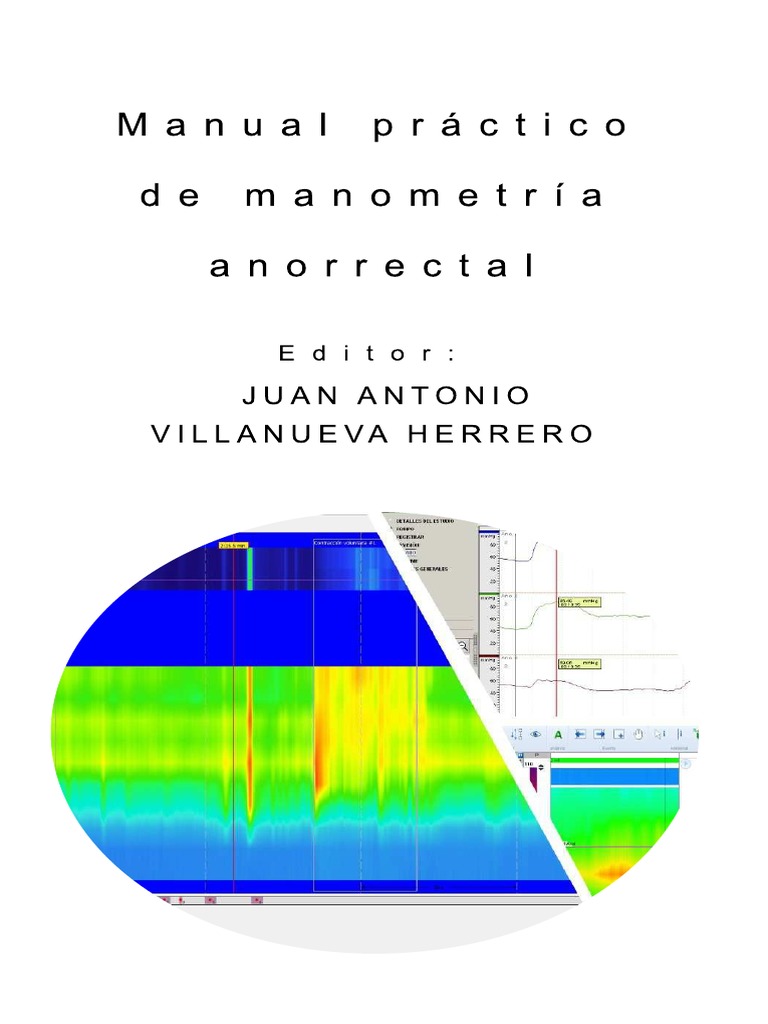 Manual de Manometría Anorrectal | PDF