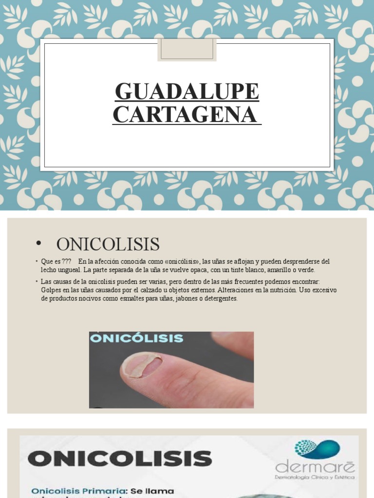 Guadalupe Onicolisis | PDF