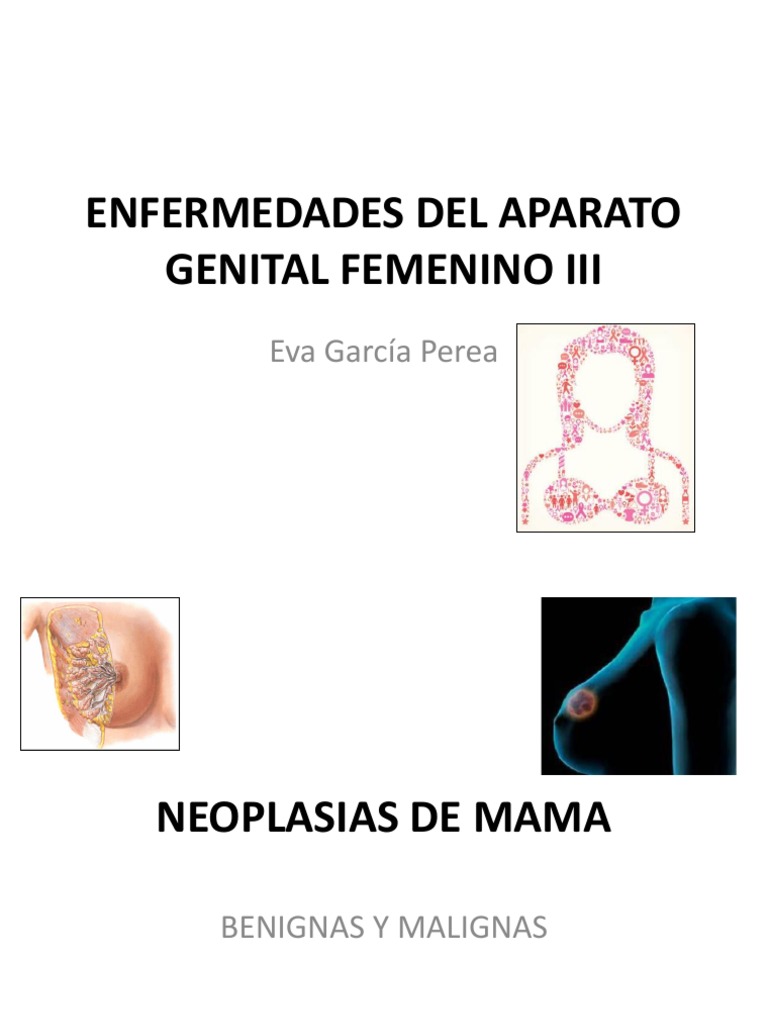 Ca Mama | PDF | Cáncer de mama | Biopsia