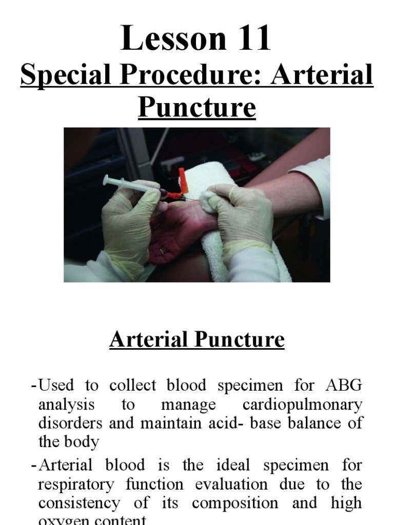 Arterial Puncture Procedure Overview | PDF | Clinical Medicine ...