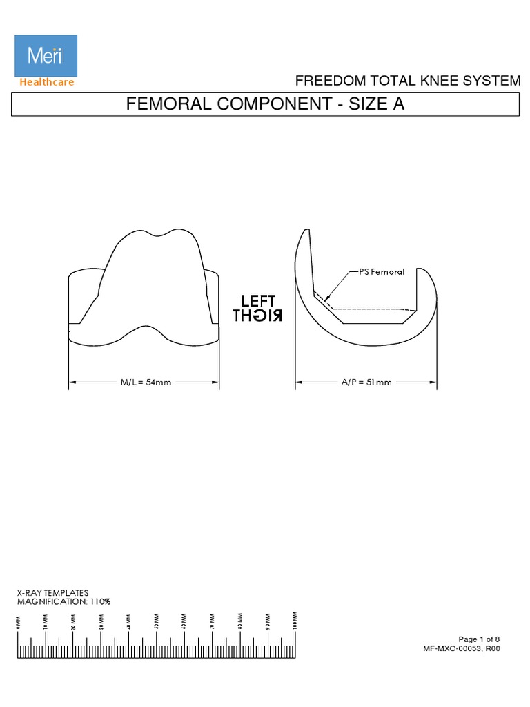FREEDOM TOTAL KNEE SYSTEM - FEMORAL COMPONENT (1) | PDF | Lower Limb ...