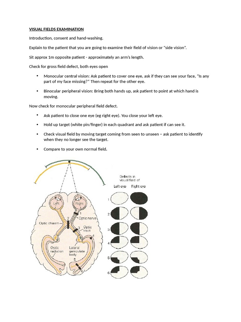 Visual Field Exam Guide for Clinicians | PDF