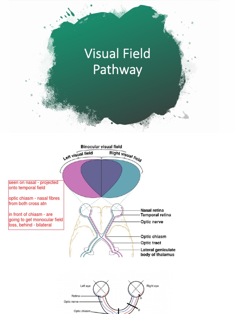 Optho Workshop One Visual Field Workshop | PDF | Language Arts ...