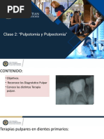 Protocolo Pulpotomia | PDF