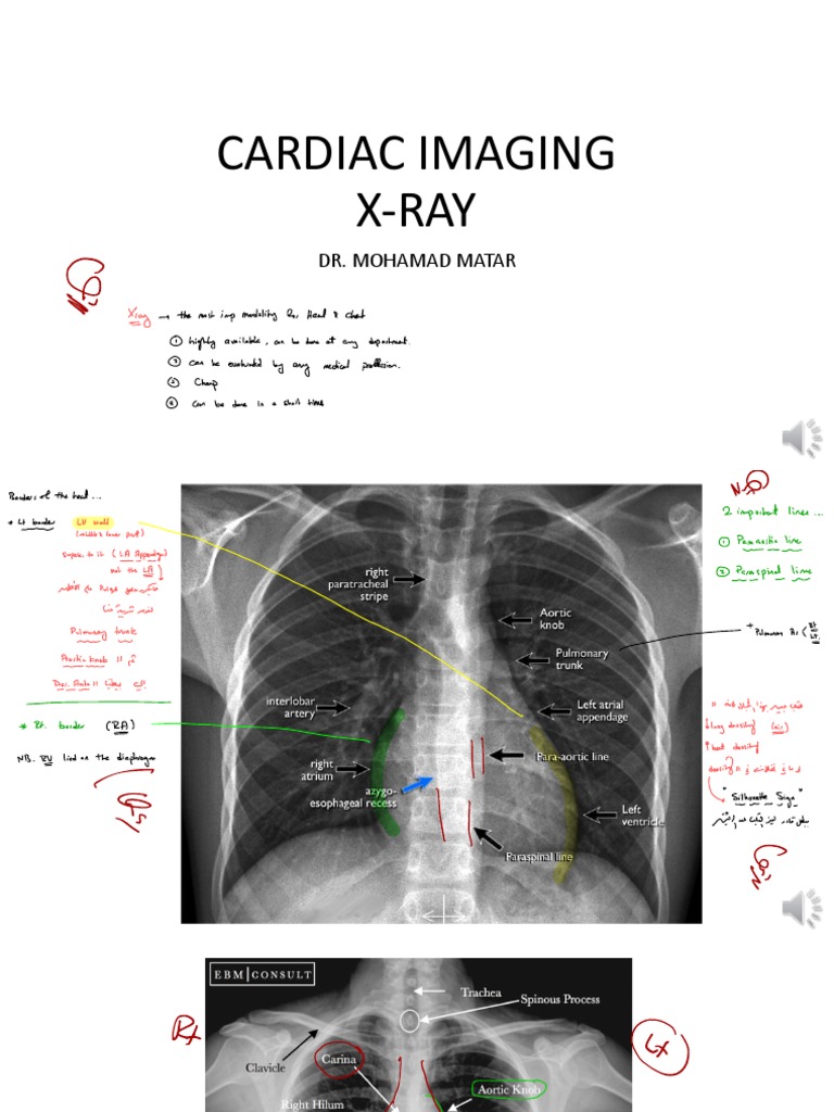 Cardio 2 - X-Ray | PDF | Heart | Ventricle (Heart)