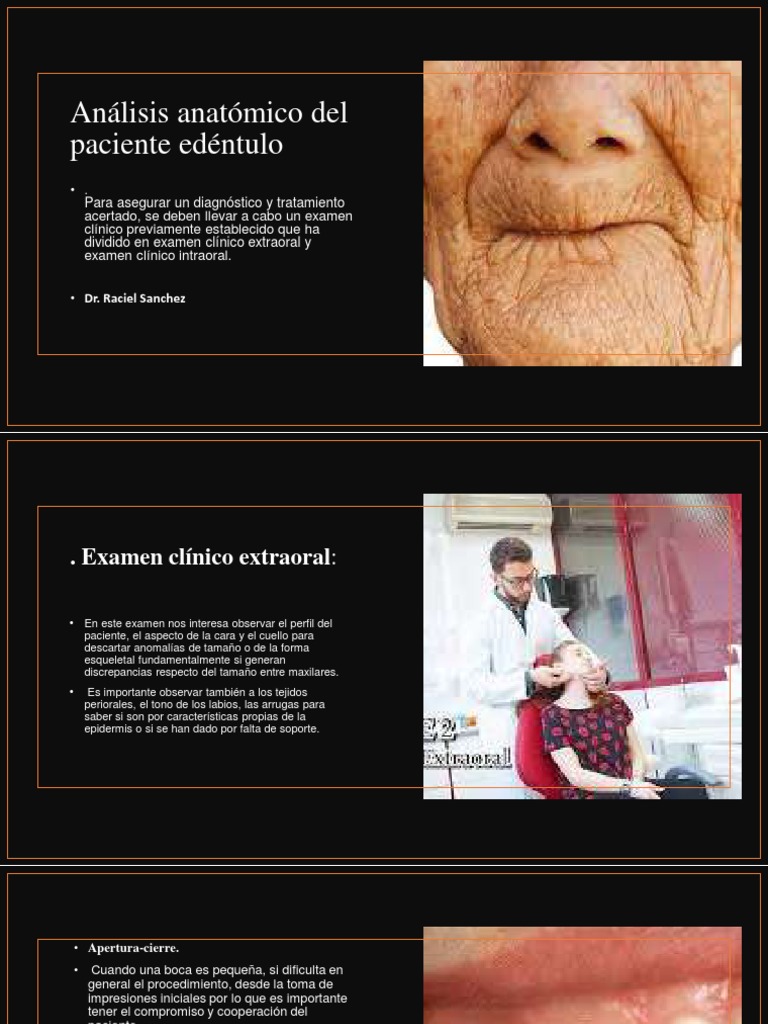 Anatomía del Paciente Edéntulo Total | PDF | Dentadura postiza | Anatomía