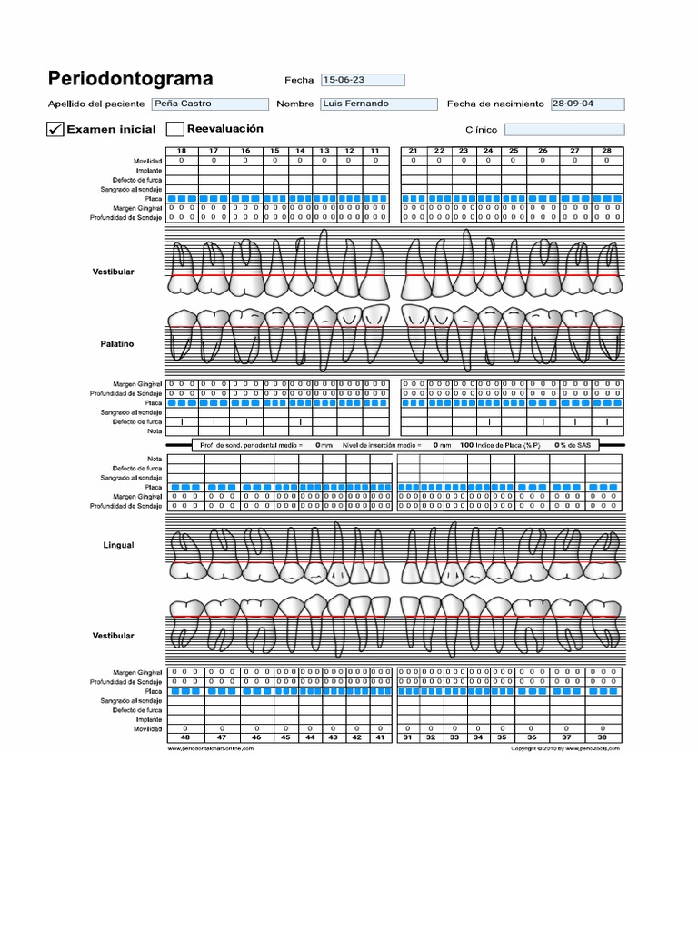 Periodontal Chart Online | PDF
