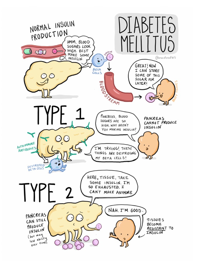 Endo Diabetes | PDF