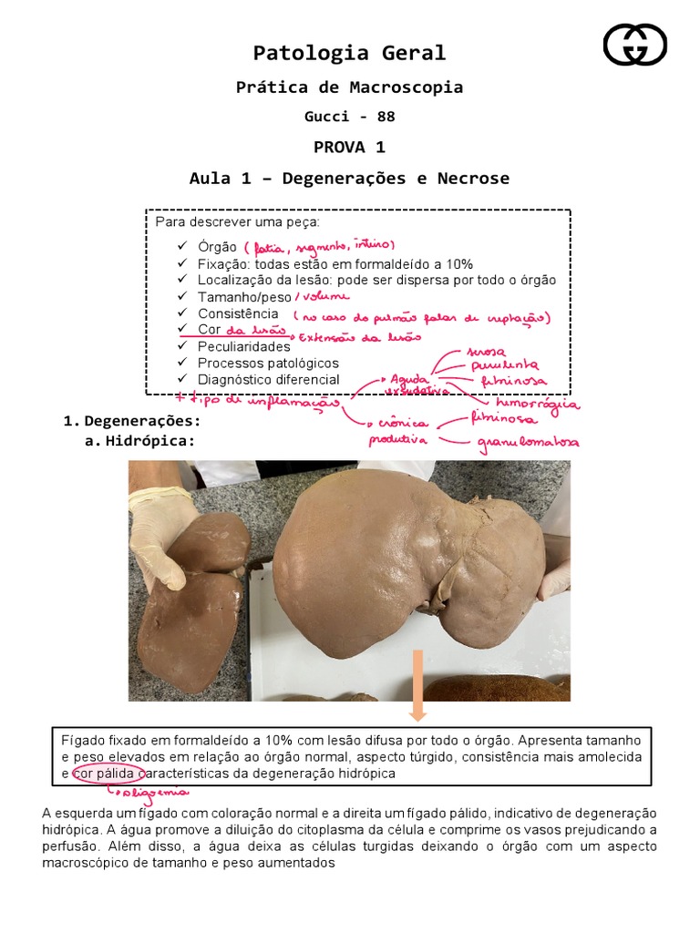Pato Macro (p1 e p2) - Gucci | PDF | Útero | Fígado