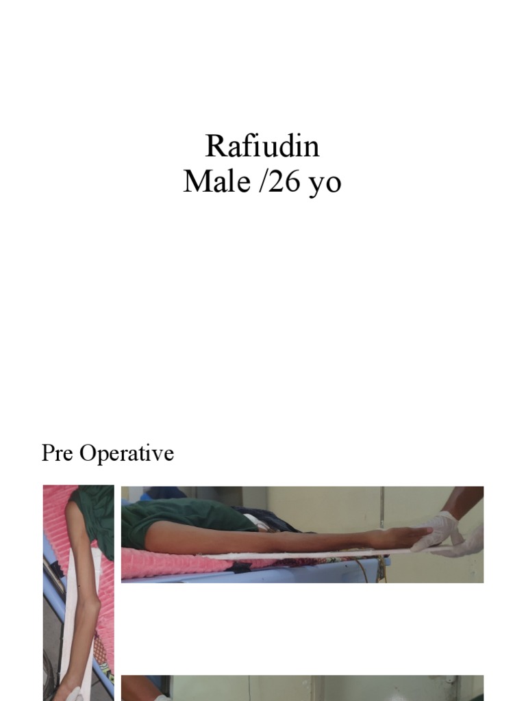 Post Op Hand Rafiuddin BN | PDF | Self-Improvement | Wellness