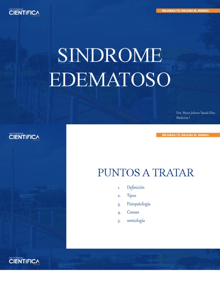 Sindrome Edematoso | PDF | Edema | Medicina CLINICA