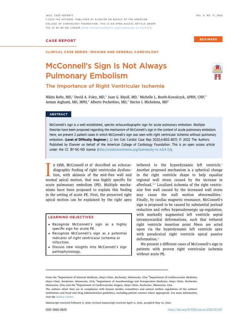 McConnell Sign | PDF | Myocardial Infarction | Ventricle (Heart)