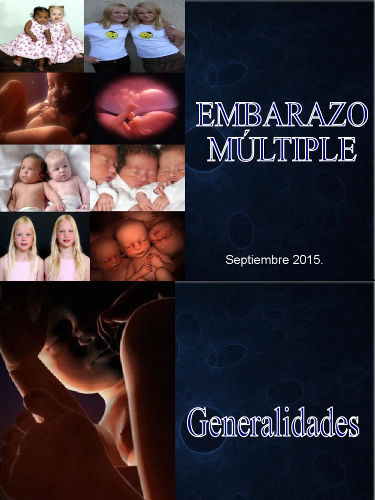 Embarazo Multiple Hector | PDF | El embarazo | Parto