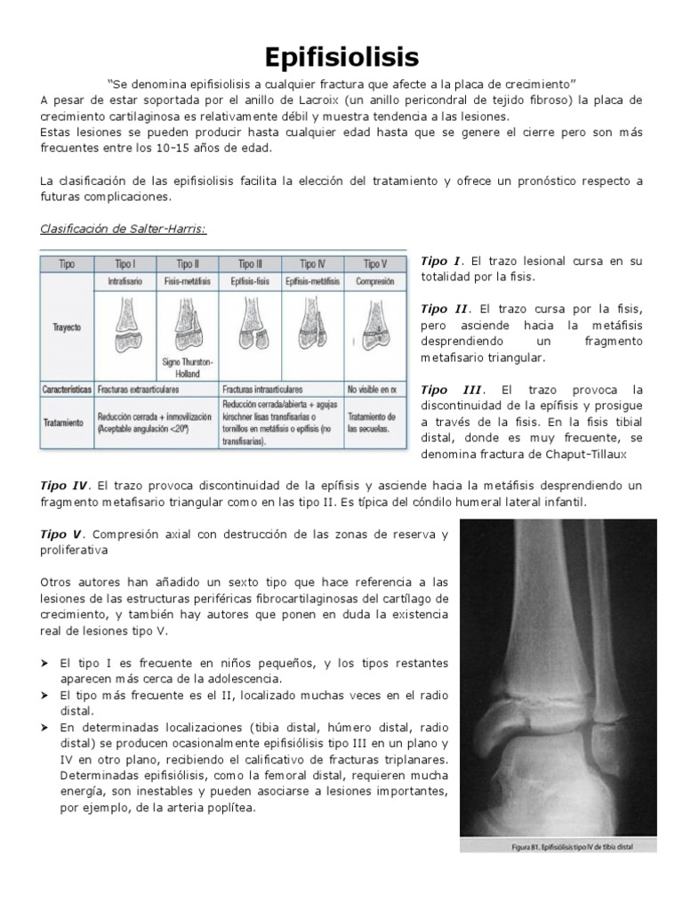 Clasificación y Tratamiento de Epifisiolisis | PDF