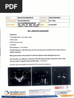 Universal ECG Sample Reports | PDF | Electrocardiography | Heart