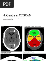 Ataxia Rating Scale Guide | PDF | Neurology | Neurological Disorders