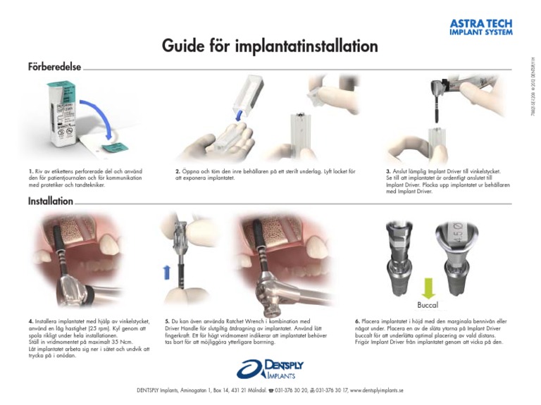 123465 Guide for implantatinstallation | PDF