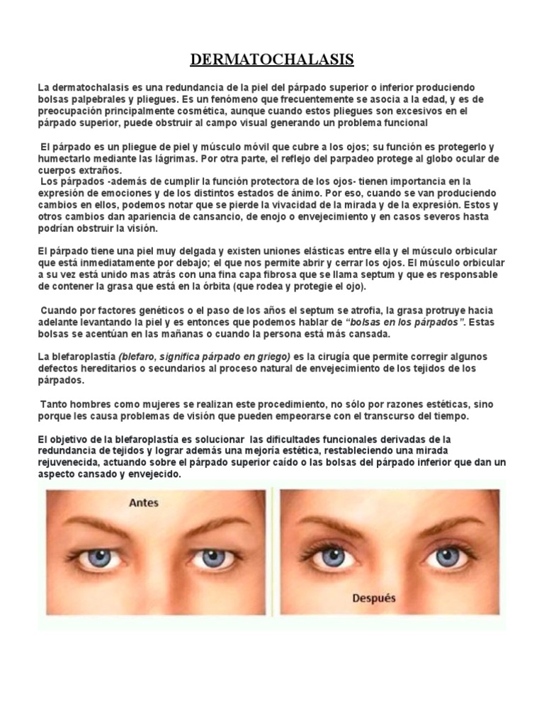 DERMATOCHALASIS (1) | PDF | Causas de la muerte | Ojo humano