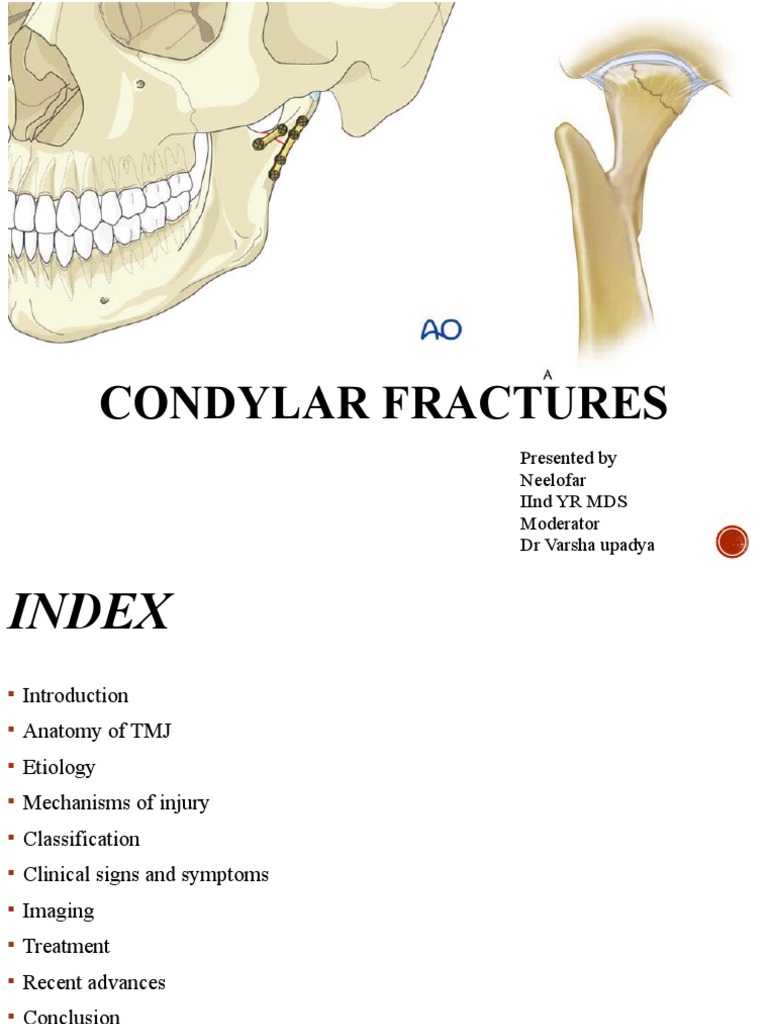 Condylar Fracture - 2 | PDF | Clinical Medicine | Musculoskeletal System