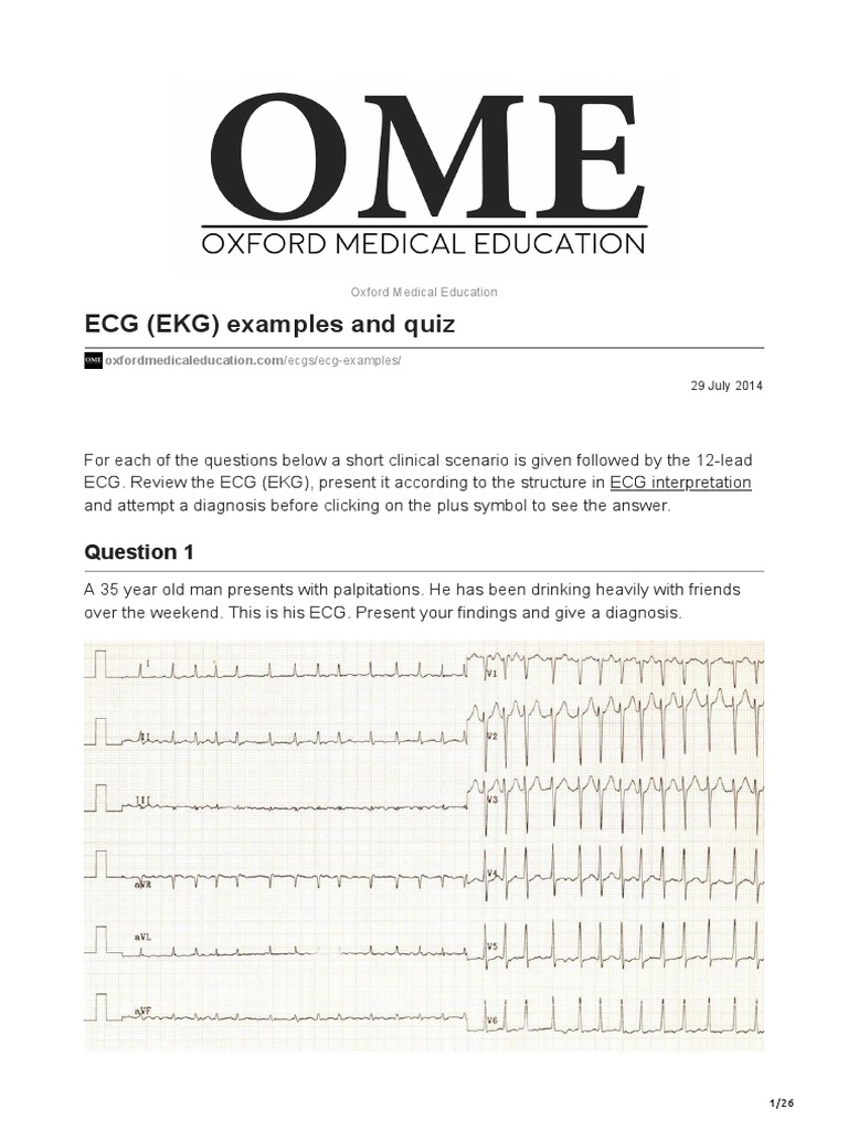 ECG EKG Examples and Quiz | PDF | Electrocardiography | Cardiac ...