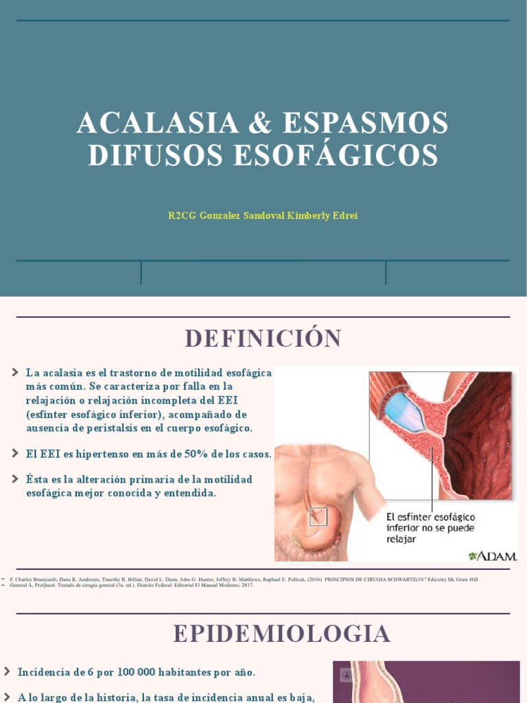 ACALASIA & espasmos difusos esofágicos | PDF | Medicina CLINICA | Medicina