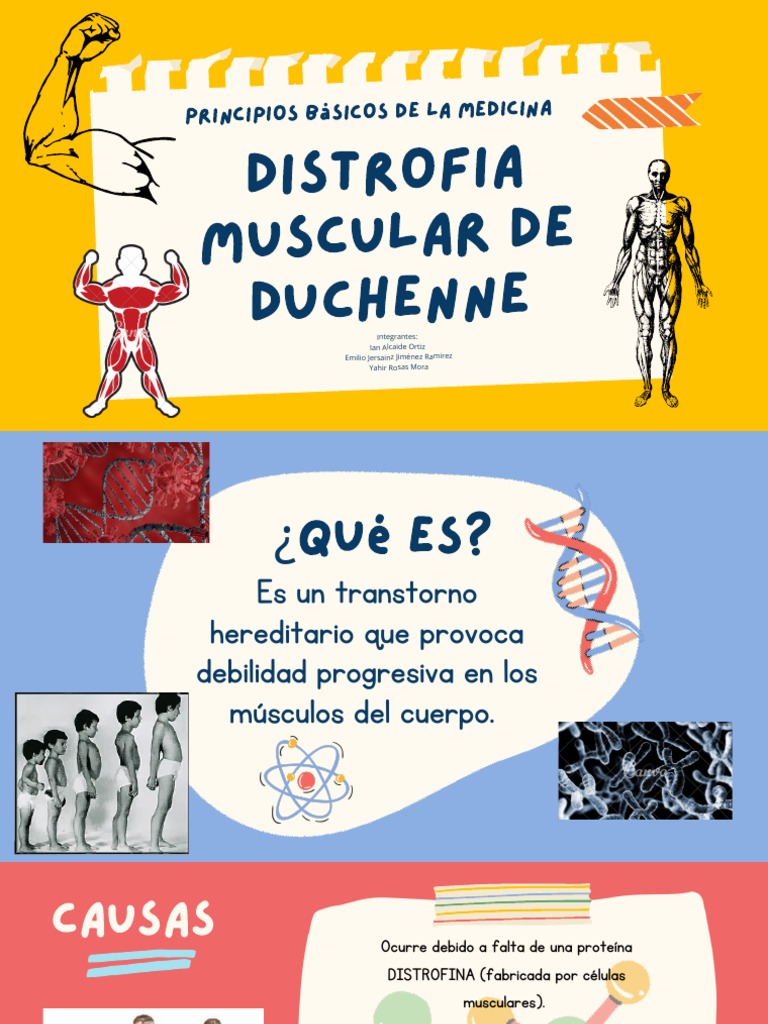 Distrofia Muscular | PDF