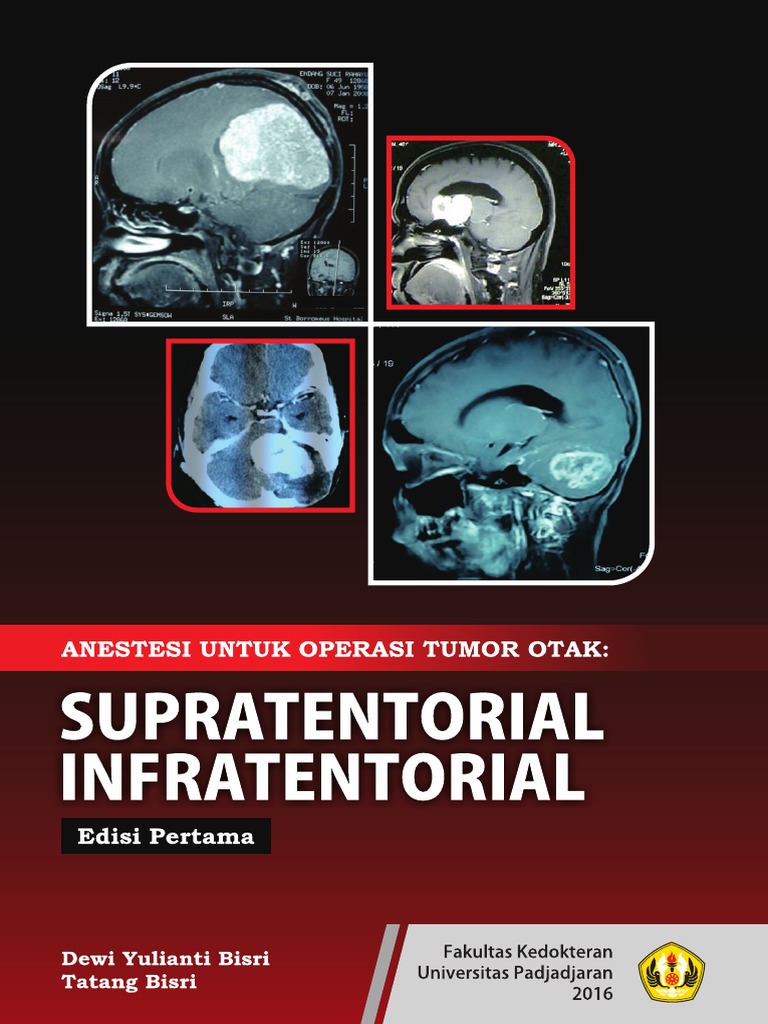YULI Supratentorial-Infratentorial 2016 Buku Yuli Tatang | PDF