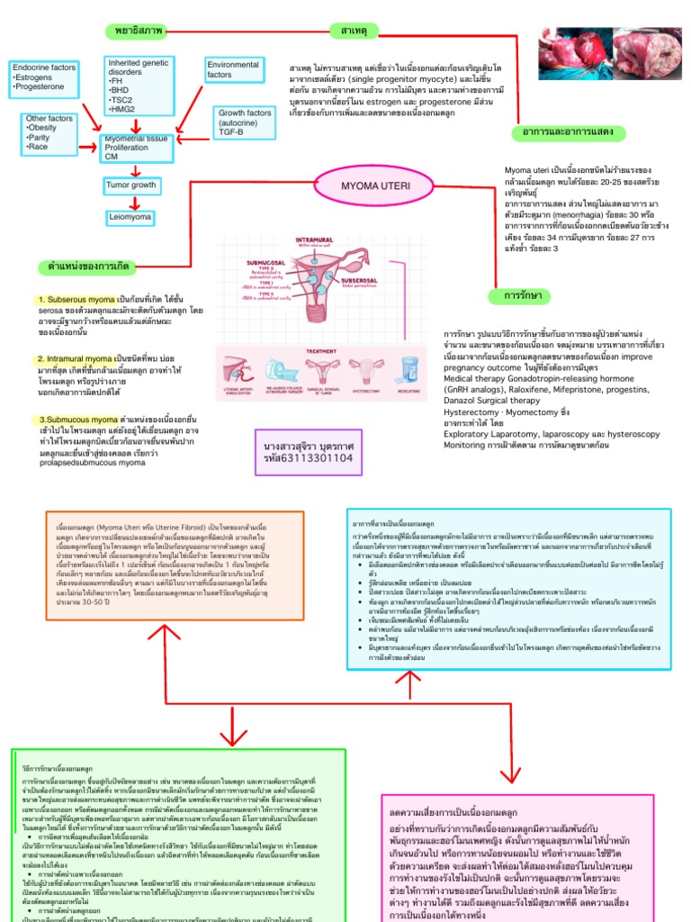 Myoma Uteri | PDF