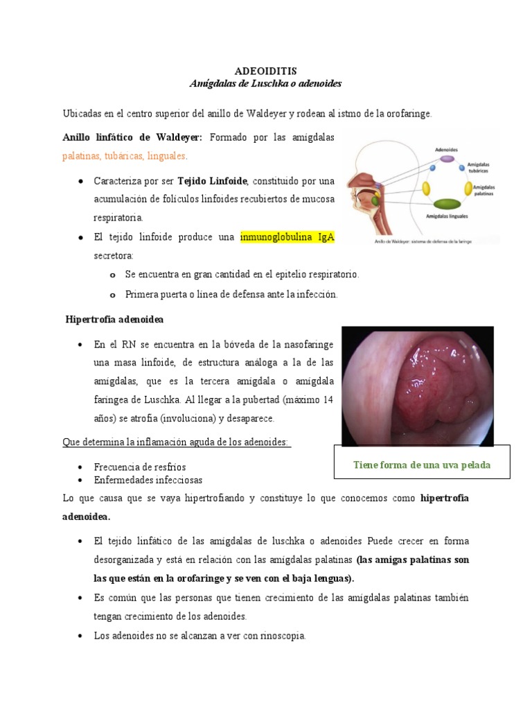 Hipertrofia Adenoidea: Causas y Tratamiento | PDF | Enfermedades y ...