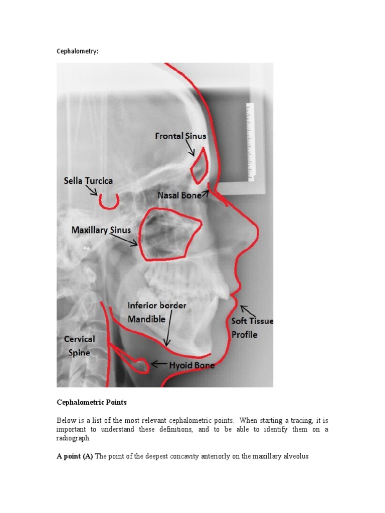 Cephalometry BE | PDF | Human Anatomy | Human Head And Neck