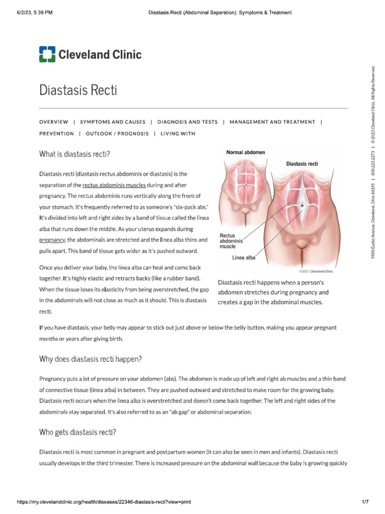 Diastasis Recti | PDF